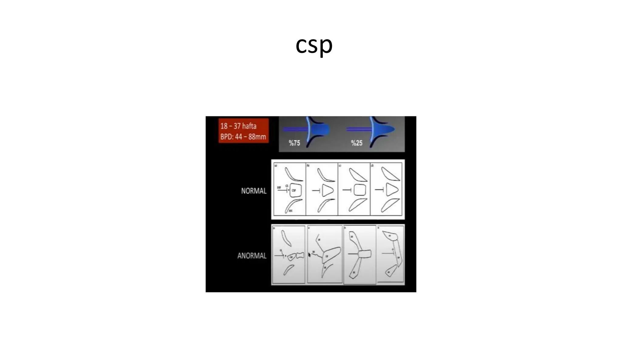 FETAL BEYİN CSP.pptx