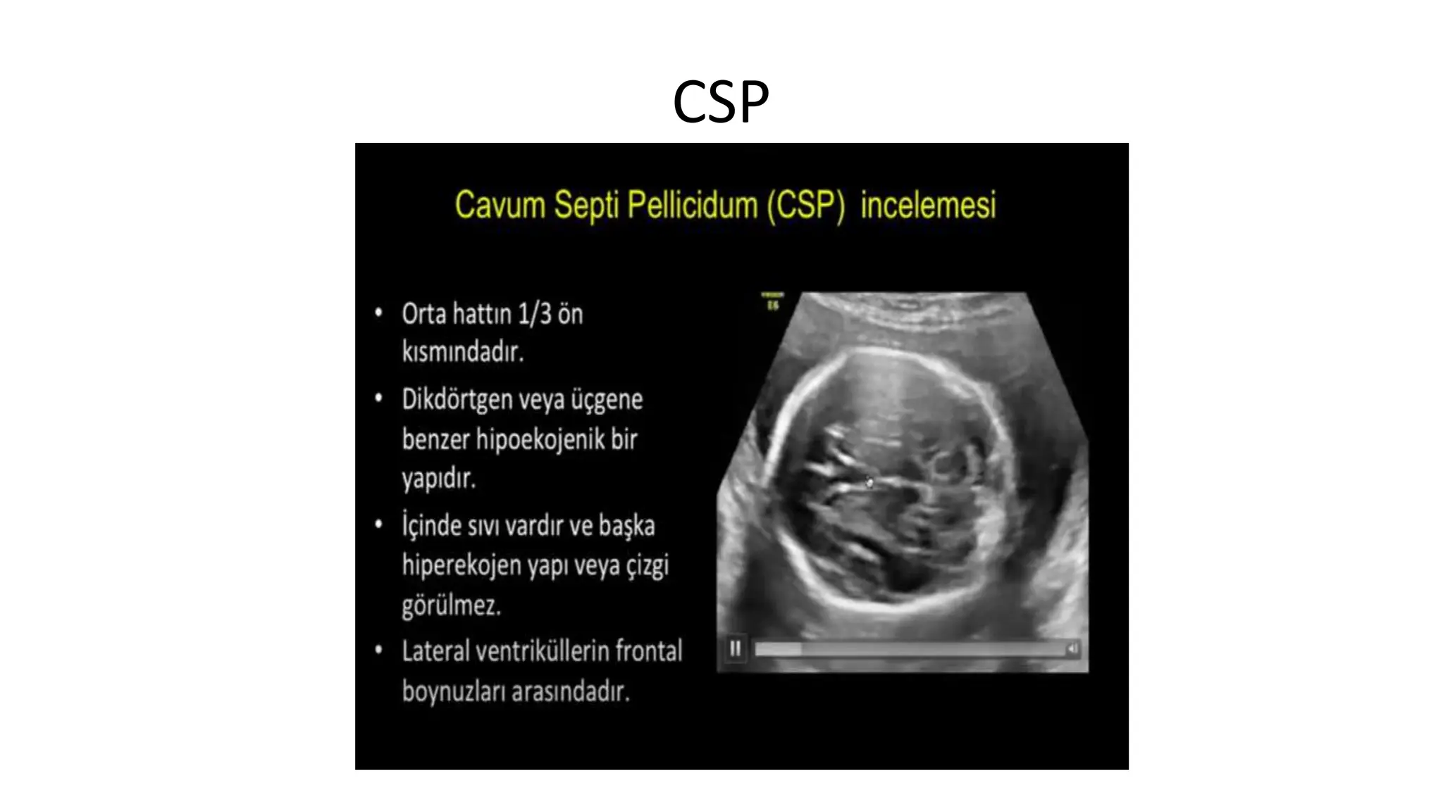 FETAL BEYİN CSP.pptx