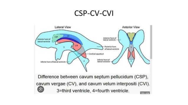 FETAL BEYİN CSP.pptx