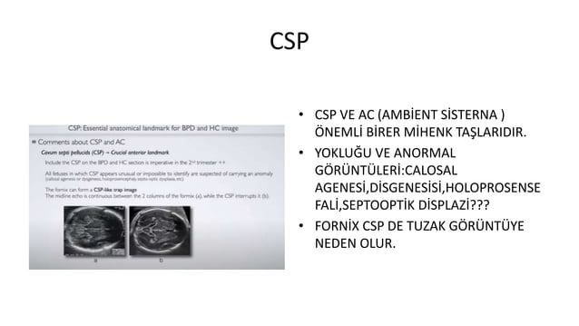 FETAL BEYİN CSP.pptx