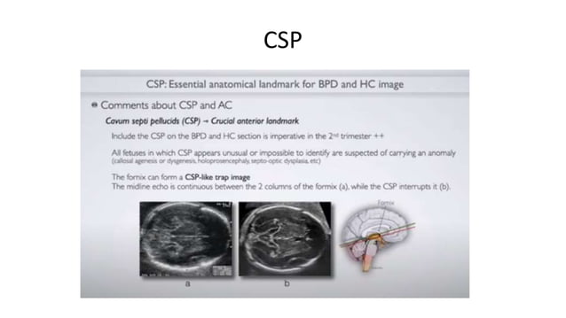 FETAL BEYİN CSP.pptx