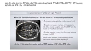 FETAL BEYİN CSP.pptx