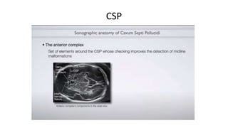 FETAL BEYİN CSP.pptx