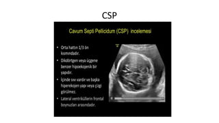 FETAL BEYİN CSP.pptx