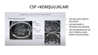 FETAL BEYİN CSP.pptx