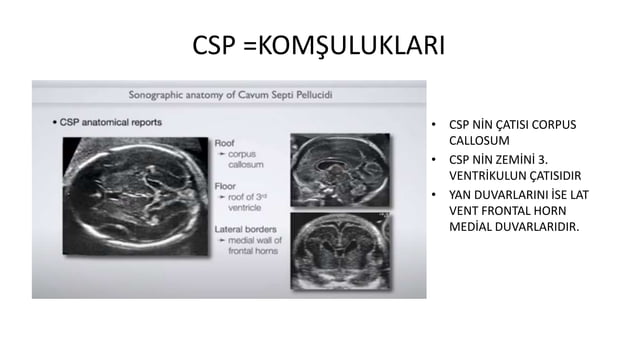 FETAL BEYİN CSP.pptx