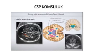 FETAL BEYİN CSP.pptx