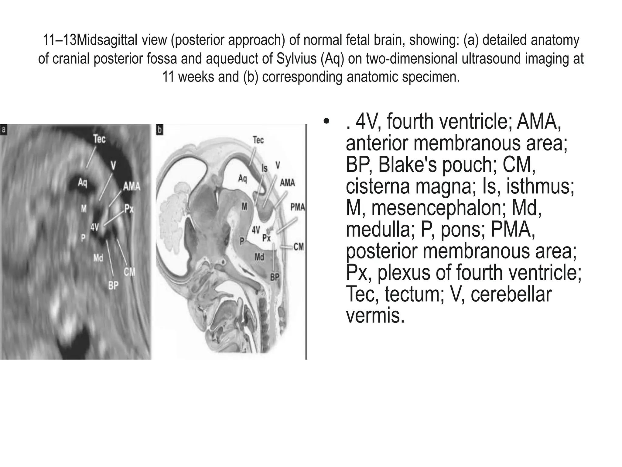 FETAL BEYİN,FETAL NÖROSONOGRAFİ,FETAL NEUROSONOGRAFİ | PPTX