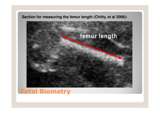 Fetal biometry | PDF