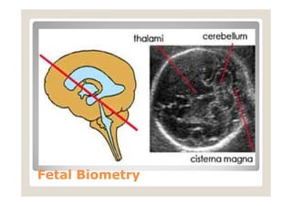 Fetal biometry | PDF
