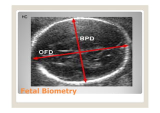 Fetal biometry | PDF