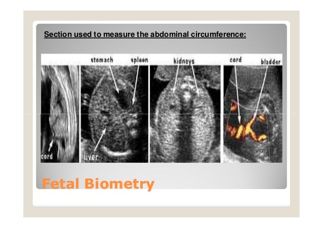 Fetal biometry