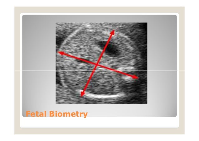 Fetal biometry