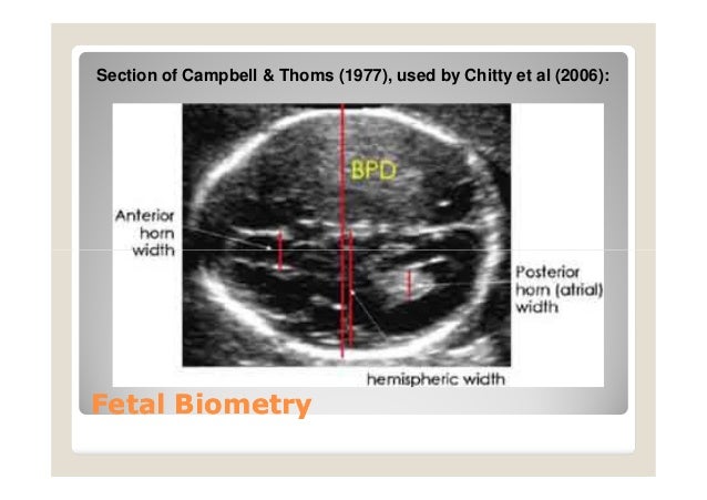 Fetal biometry