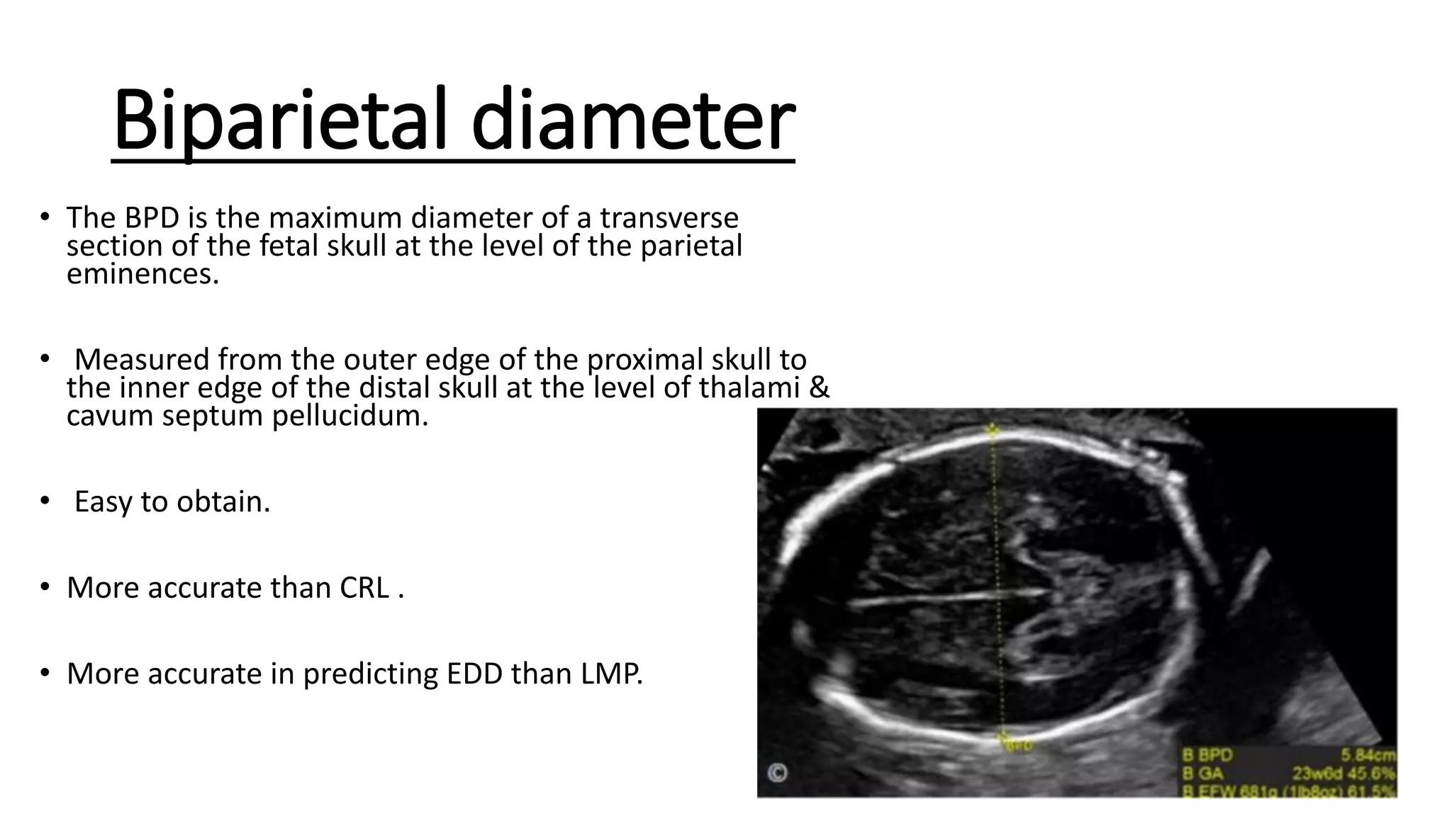 Fetal biometry parameters lk | PPTX