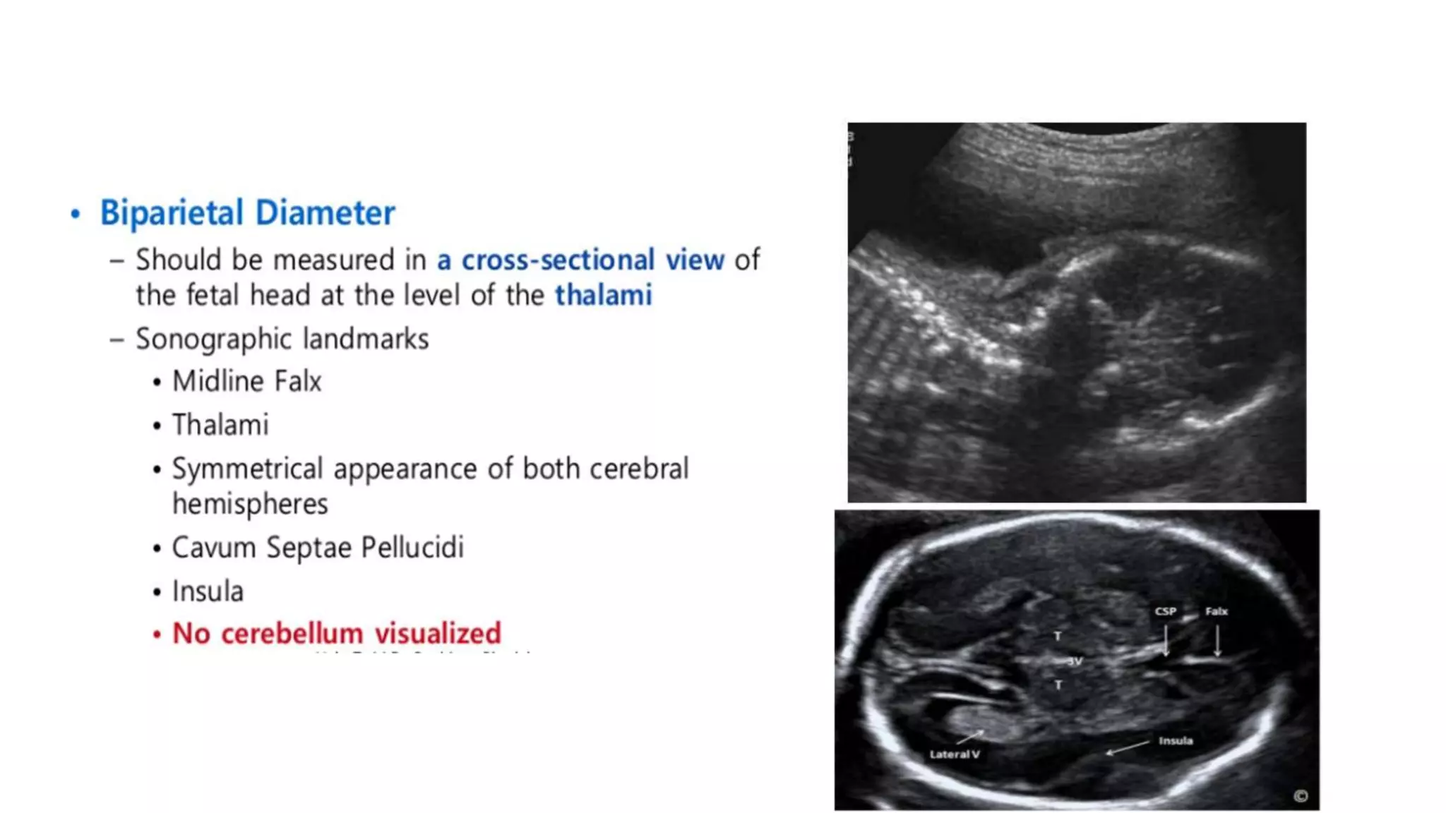 Fetal biometry parameters lk | PPTX