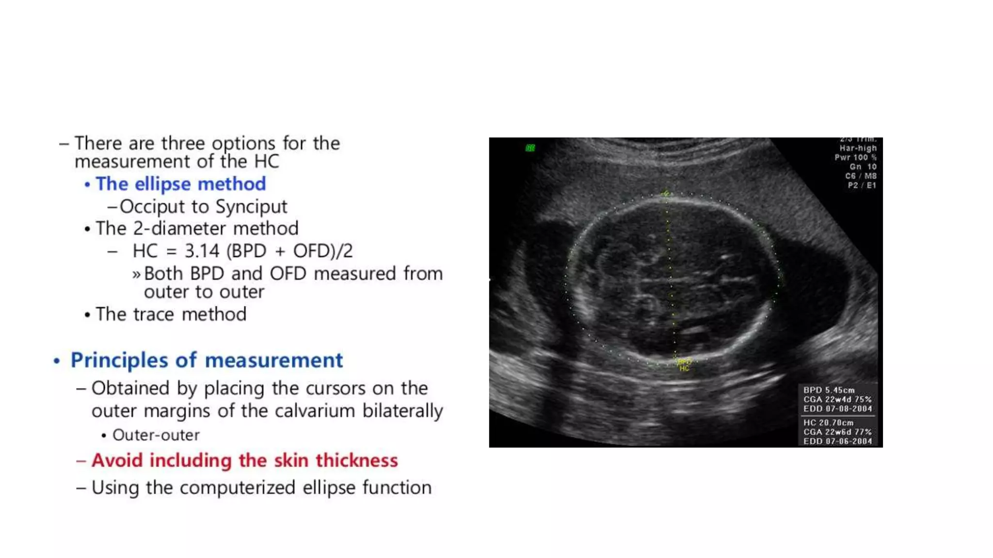 Fetal biometry parameters lk | PPTX