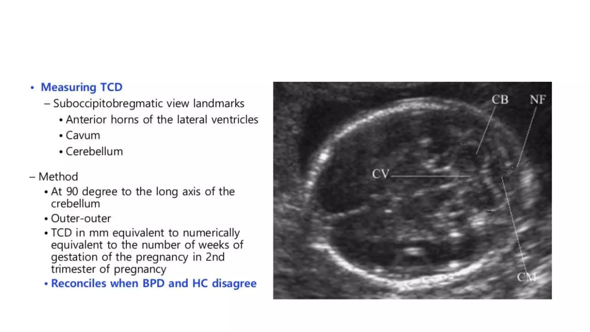 Fetal biometry parameters lk | PPTX