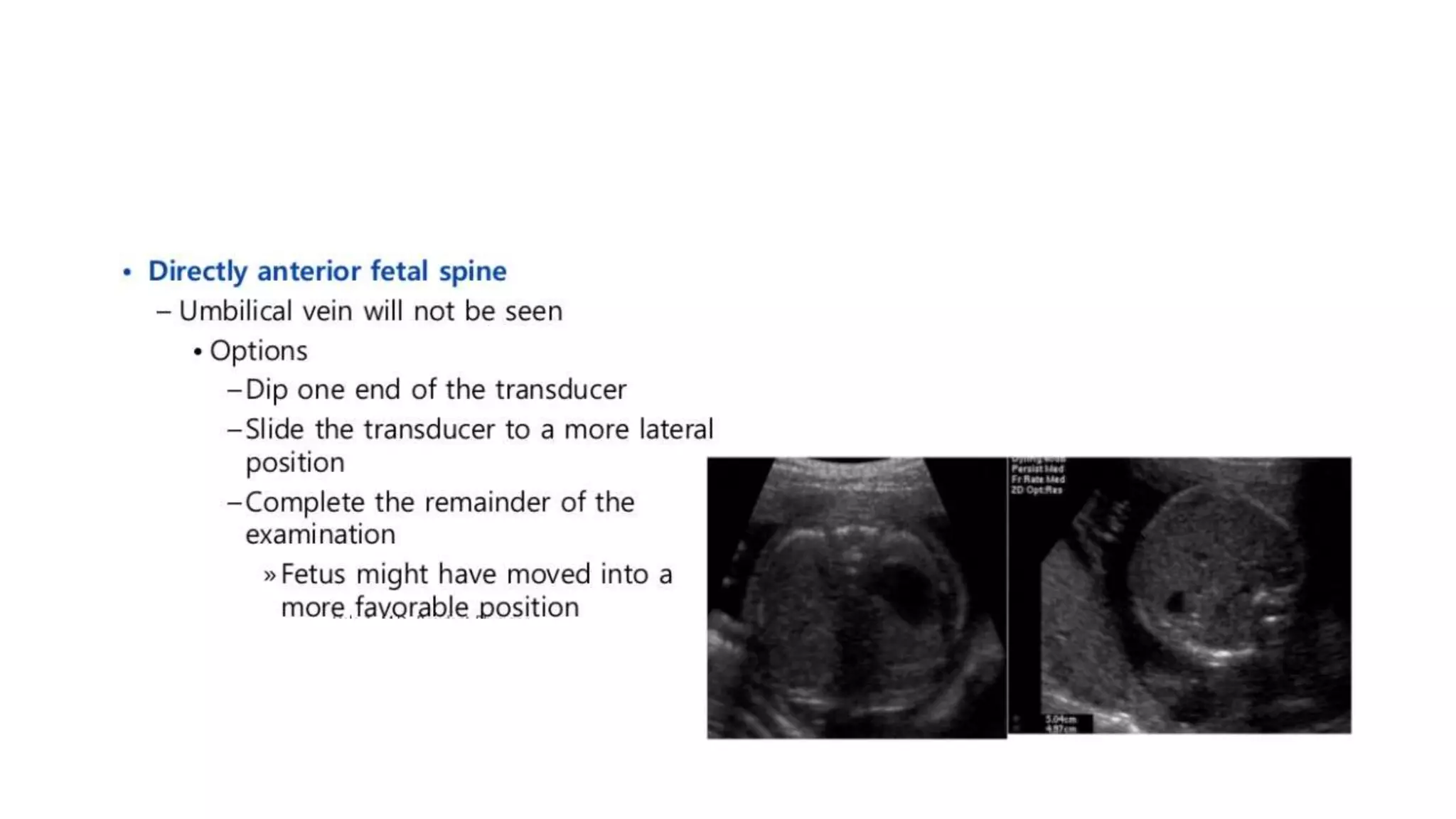 Fetal biometry parameters lk | PPTX