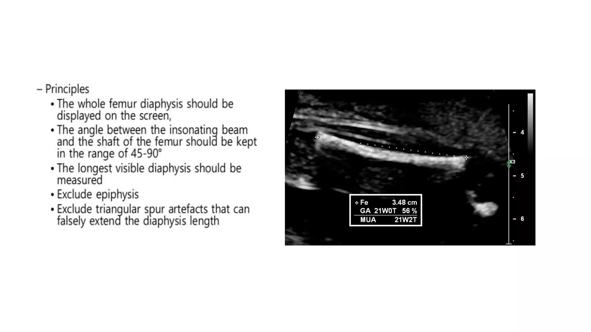 Fetal biometry parameters lk | PPTX