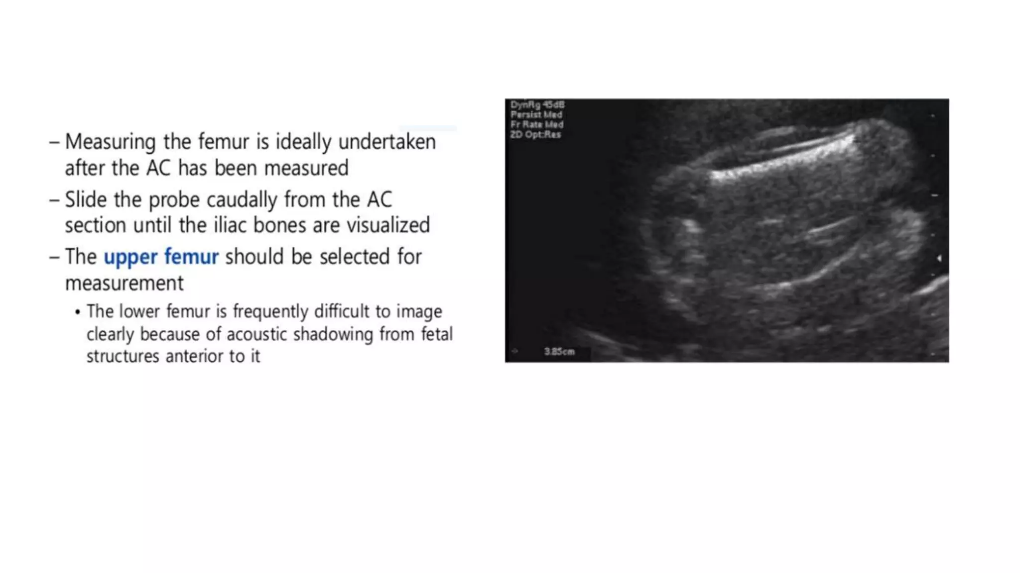 Fetal biometry parameters lk | PPTX