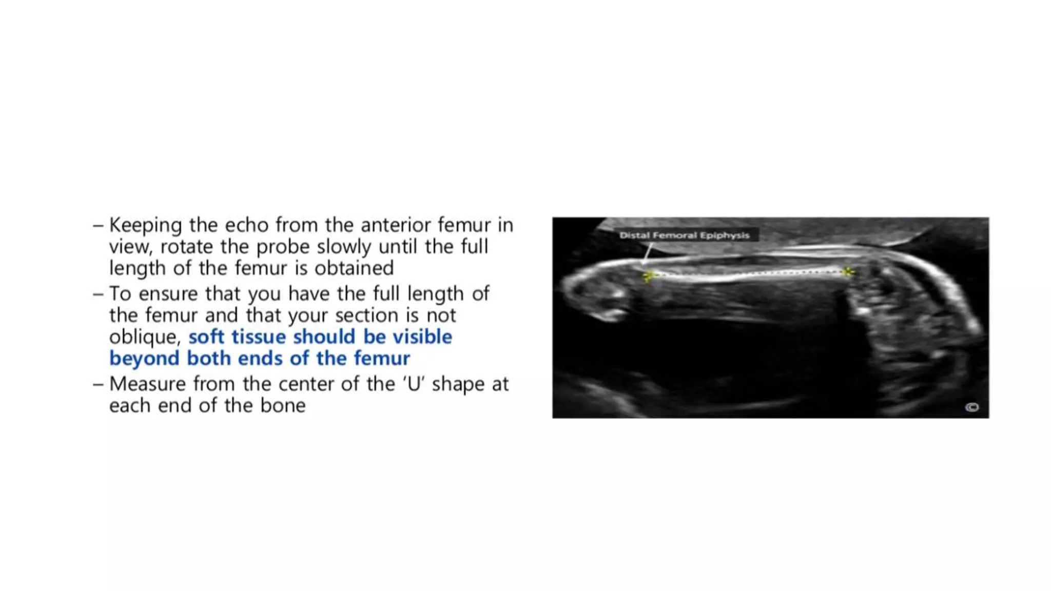 Fetal biometry parameters lk | PPTX