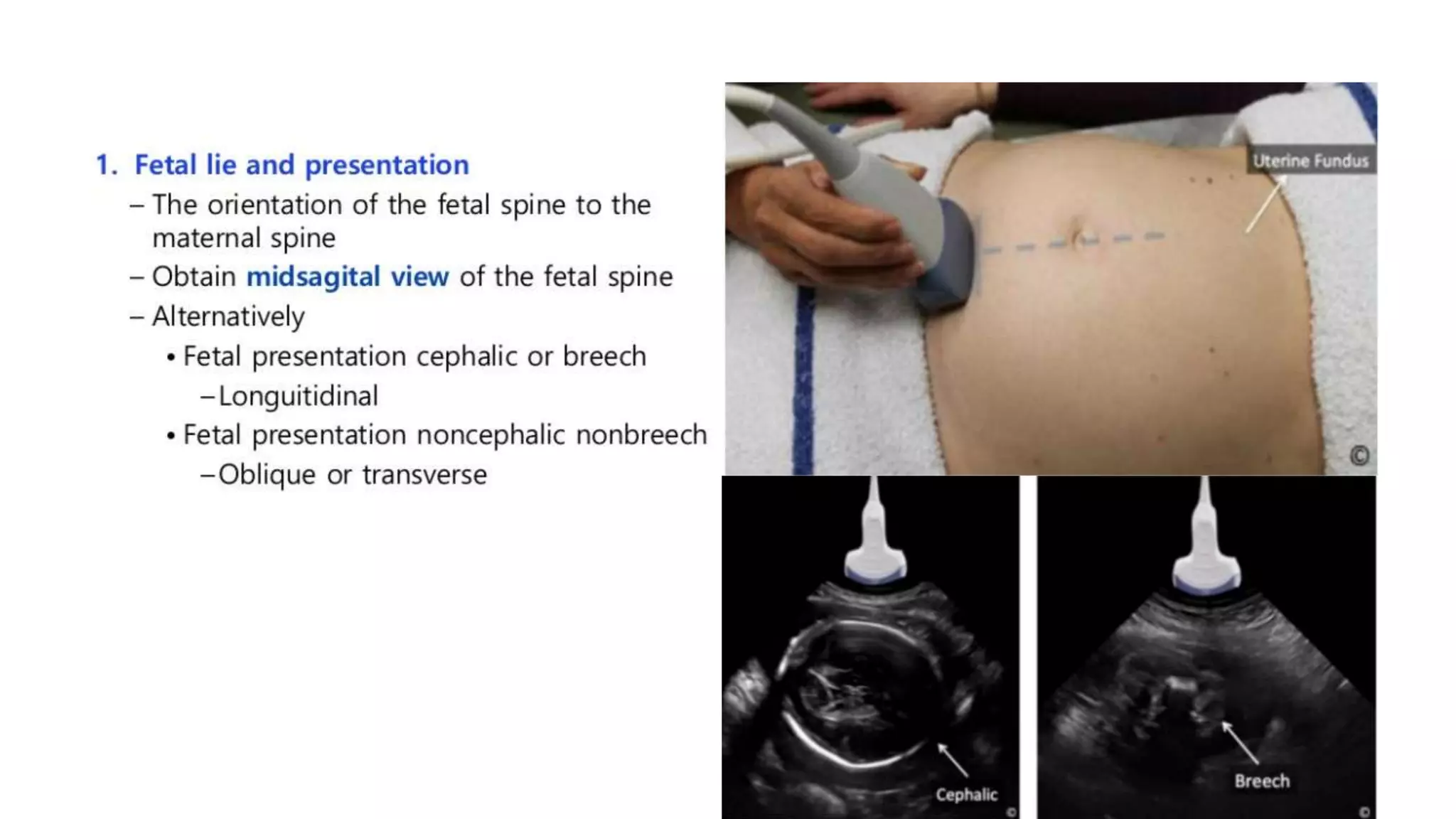 Fetal biometry parameters lk | PPTX
