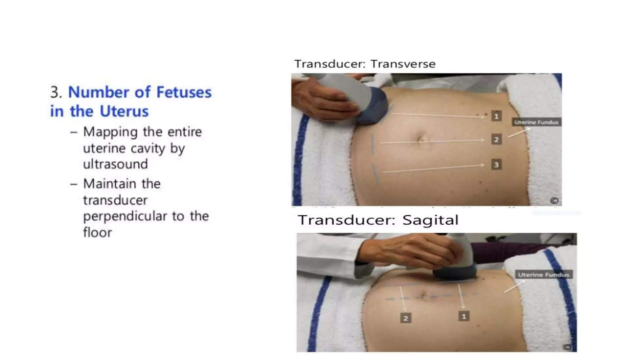 Fetal biometry parameters lk | PPTX