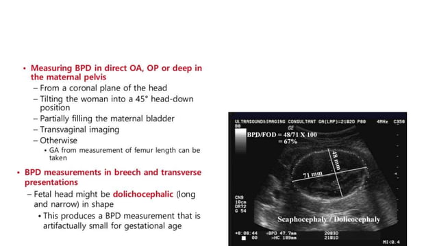 Fetal biometry parameters lk | PPTX | Pregnancy | Reproductive Health