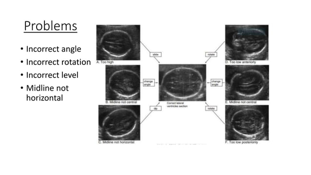 Fetal biometry parameters lk | PPTX | Pregnancy | Reproductive Health