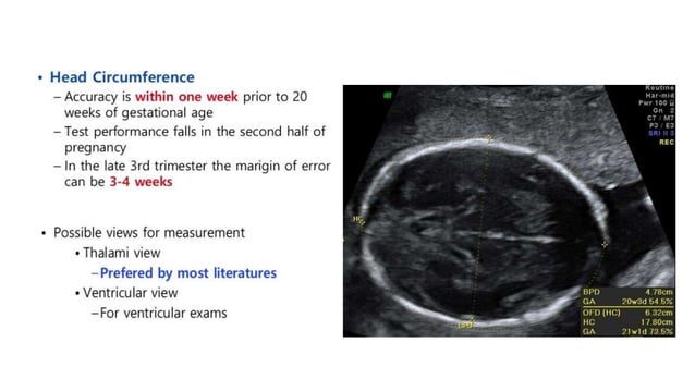 Fetal biometry parameters lk | PPTX | Pregnancy | Reproductive Health