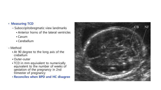 Fetal biometry parameters lk | PPTX | Pregnancy | Reproductive Health