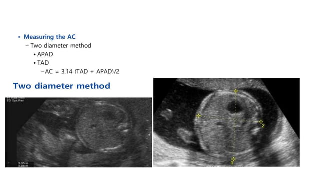 Fetal biometry parameters lk | PPTX | Pregnancy | Reproductive Health