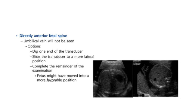 Fetal biometry parameters lk | PPTX | Pregnancy | Reproductive Health