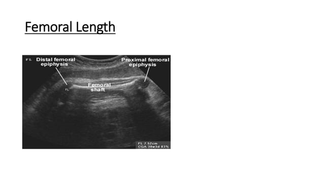 Fetal biometry parameters lk | PPTX | Pregnancy | Reproductive Health