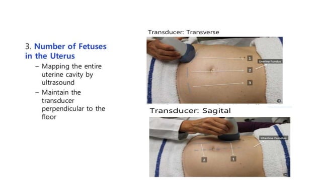 Fetal biometry parameters lk | PPTX | Pregnancy | Reproductive Health