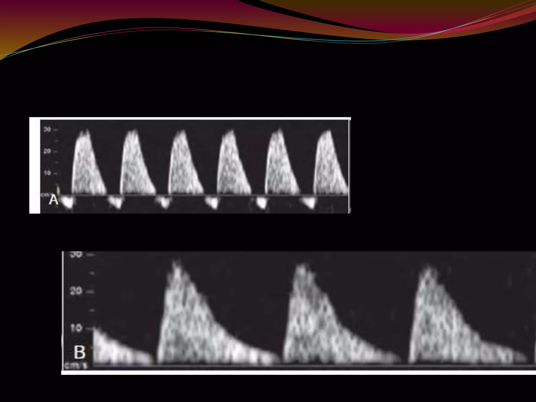Fetal biophysical profile | PPTX
