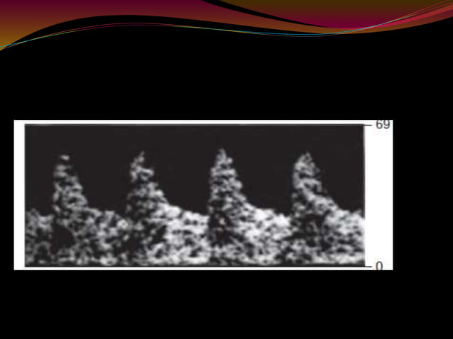 Fetal biophysical profile | PPTX