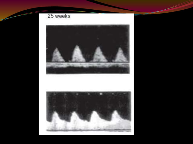 Fetal biophysical profile | PPTX