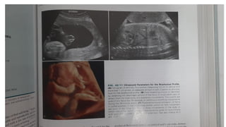 Fetal Biophysical profilekgkgjggkgjgjg.pptx