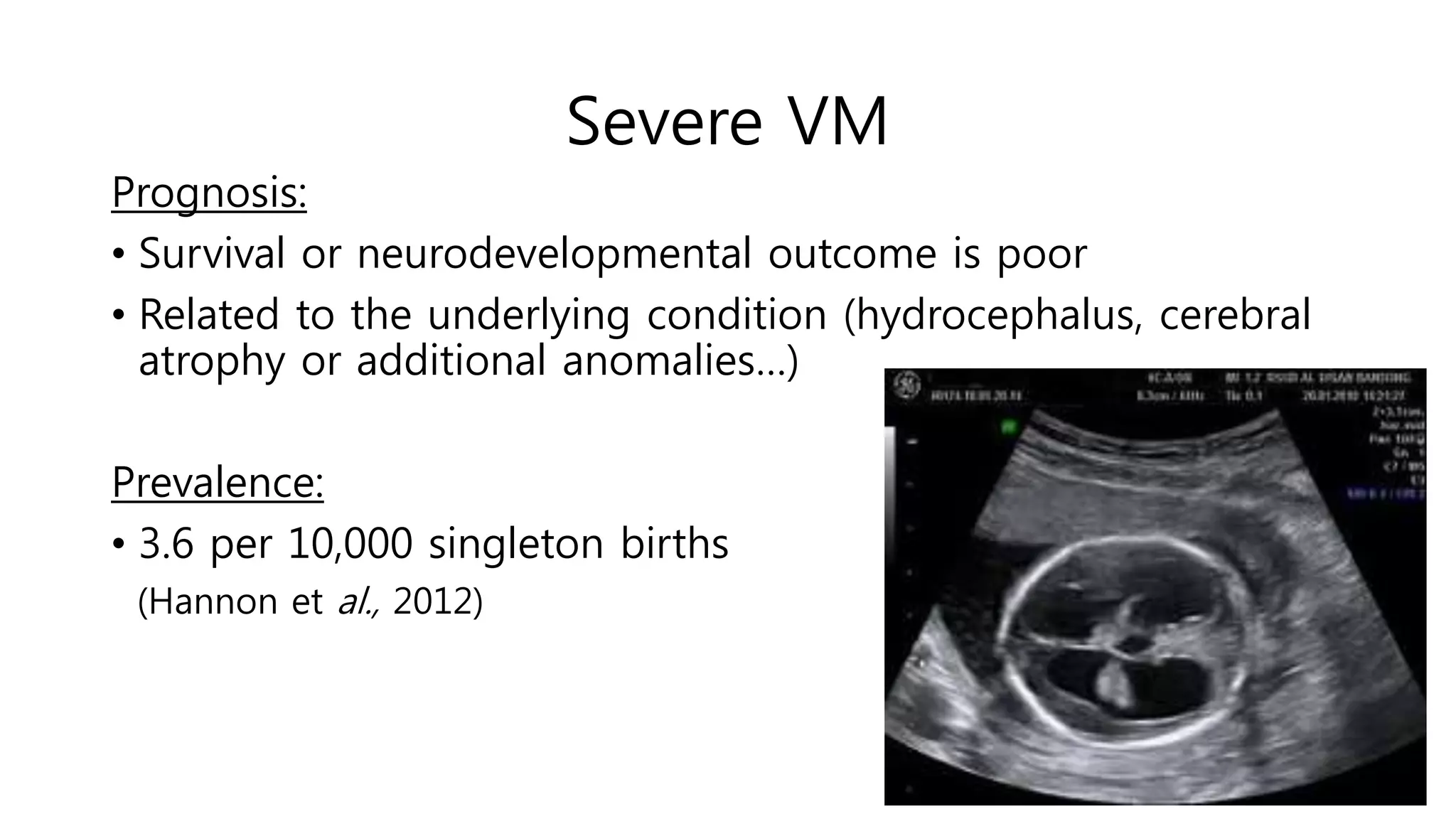 Fetal brain anomalies | PPTX