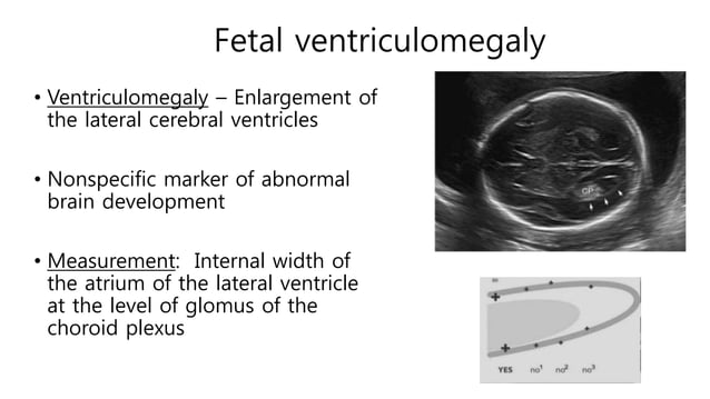 Fetal brain anomalies | PPTX | Pregnancy | Reproductive Health