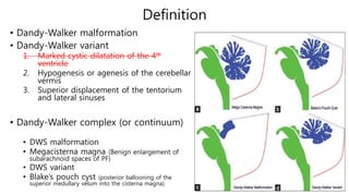 Fetal brain anomalies | PPTX