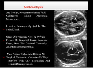 Arachnoid Cyst Ultrasound