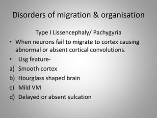 Fetal brain usg 3 | PPTX