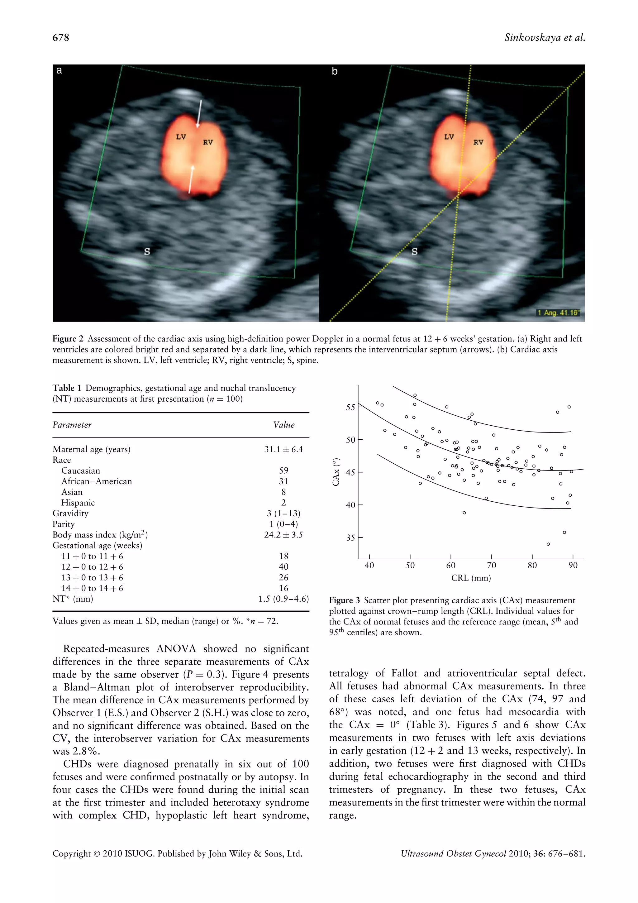 Fetal cardiac axis in 1st trimester | PDF