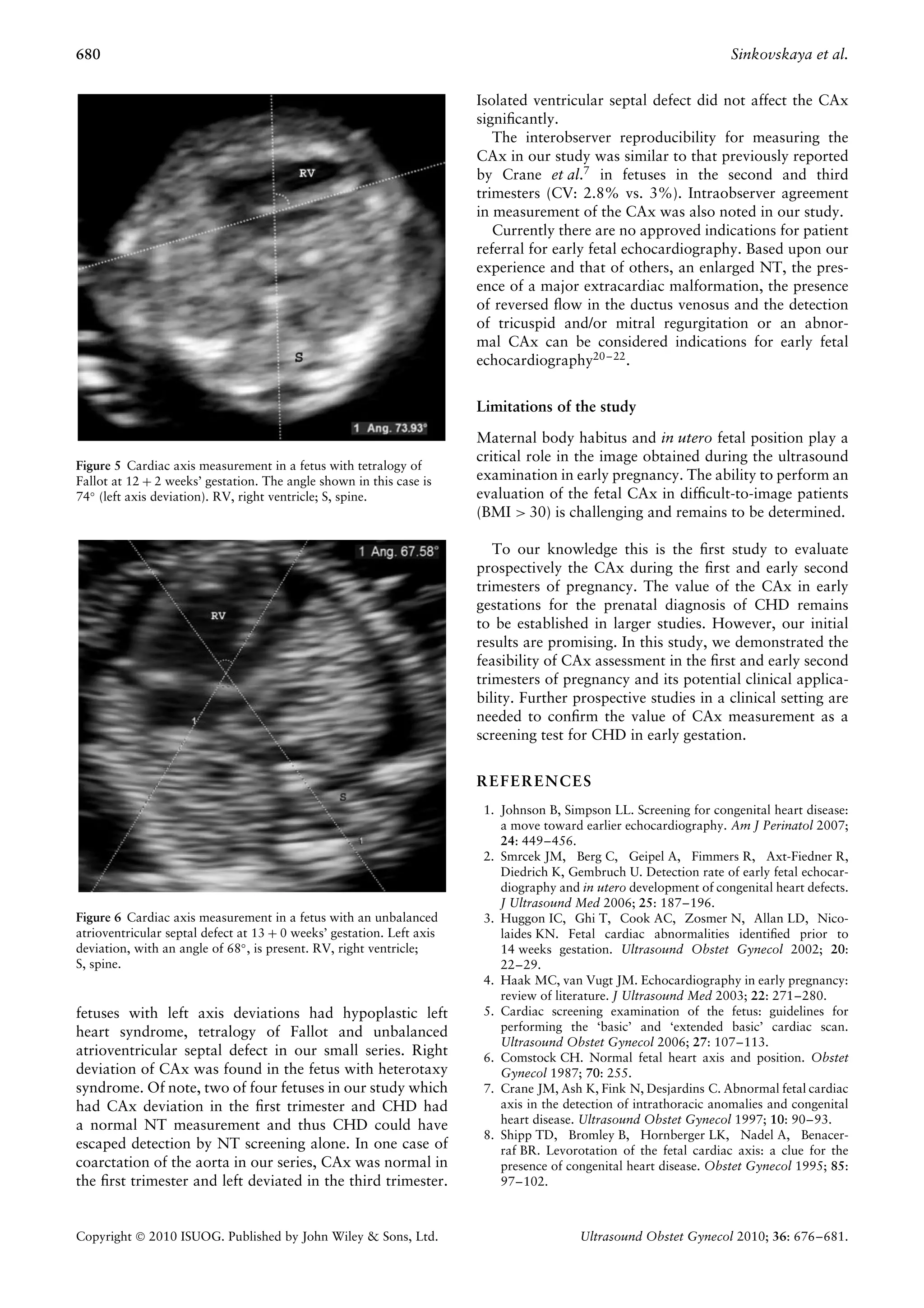 Fetal cardiac axis in 1st trimester | PDF