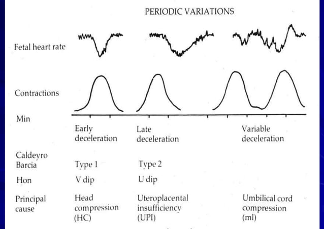 Fetal Cardiotocograph (CTG).pptx | Pregnancy | Reproductive Health