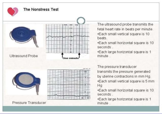 Fetal Cardiotocograph (CTG).pptx | Pregnancy | Reproductive Health