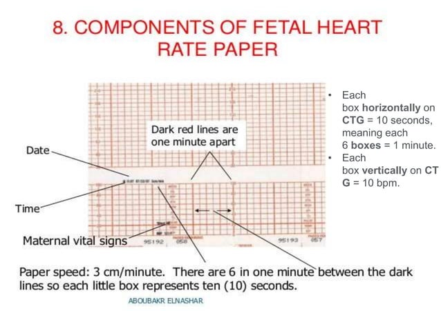 Fetal Cardiotocograph (CTG).pptx | Pregnancy | Reproductive Health